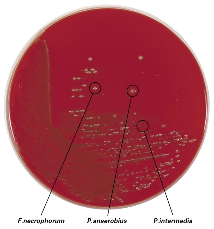 アキュレート™ ABHK寒天培地 | 食品・環境検査分野 衛生管理関連サイト コスモ会 | 島津ダイアグノスティクス株式会社
